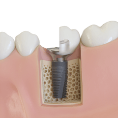 DS Signature Workflows