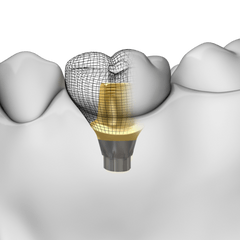 DS Signature Workflows
